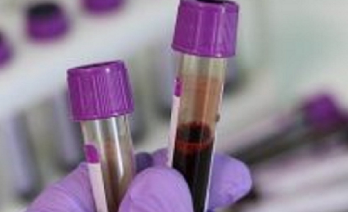 Cât te costă să faci testul pentru depistarea anticorpilor Covid-19 la ...